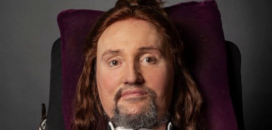 Jason Becker Hospitalized With “Shortness Of Breath And Rapid Heart ...