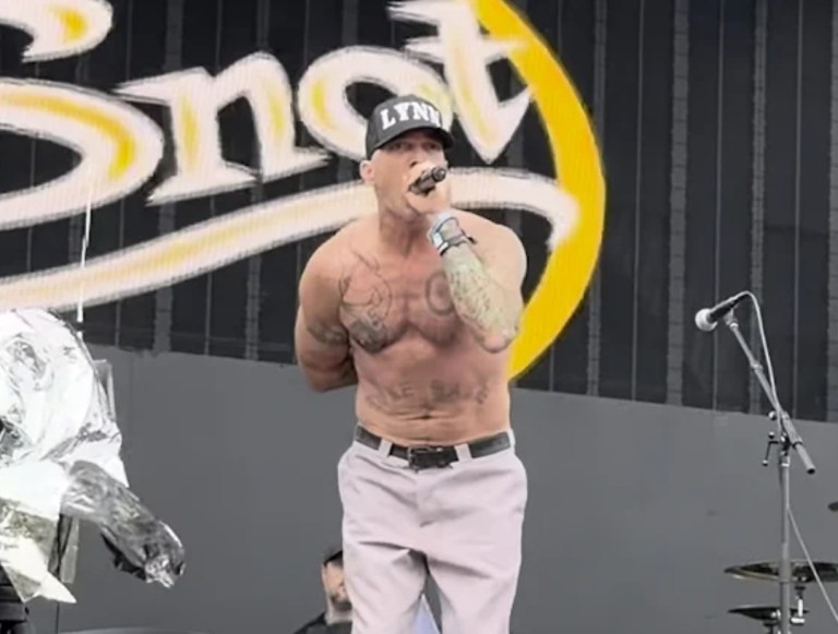 Snot Singer Andy Knapp Suffers “Significant Leg Injury” Following Stage ...